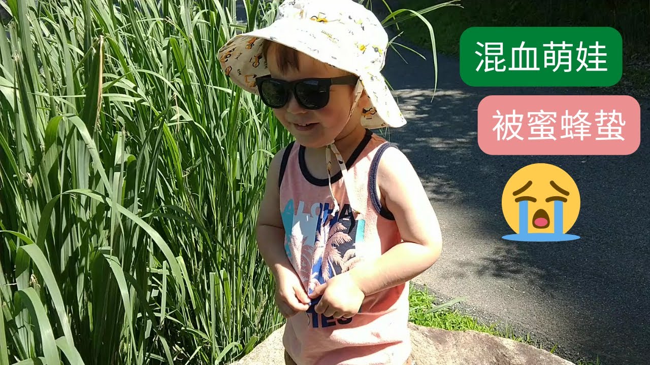 2 Year Old Go To Park Stung By A 2-year-old-go-to-park-stung-by-a