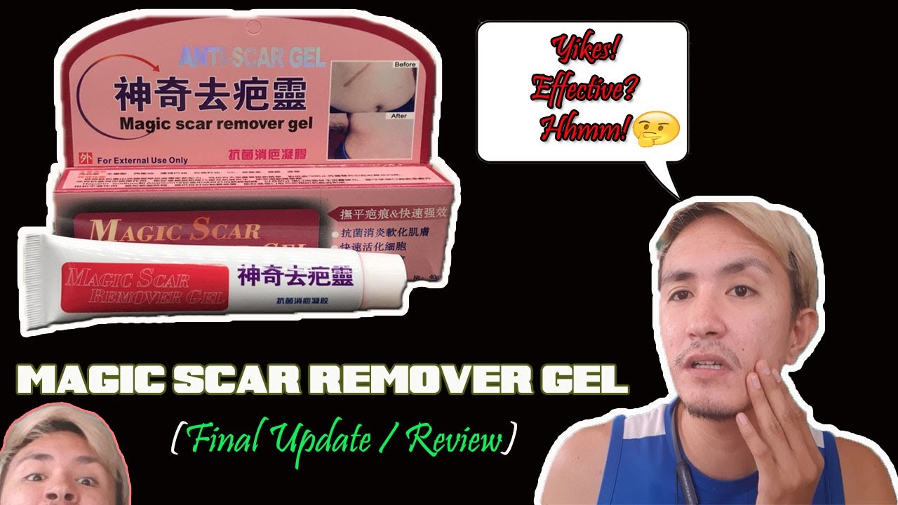 Product Review EP12 | Magic Scar Remover Gel | (Final Update/Review) # ...