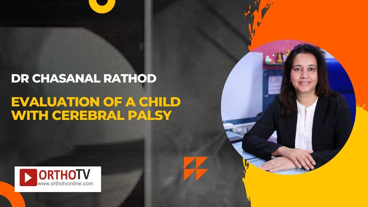 OrthoTV Original - Evaluation of a child with Cerebral Palsy - Dr ...