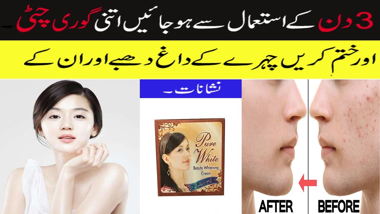 Best Pakistani 3 Days Face Whitening & Acne Removal Cream . Pure White ...