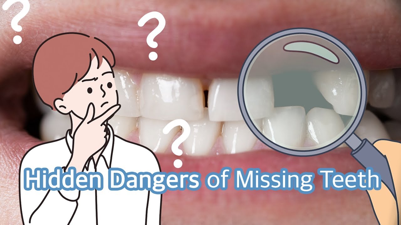 The Hidden Dangers of Missing Teeth - YouTube