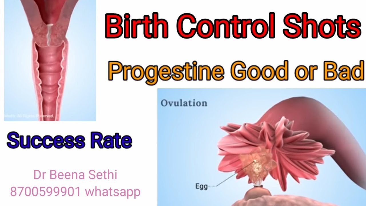 Birth Control Shots Progestine Good or Bad Success Rate ...
