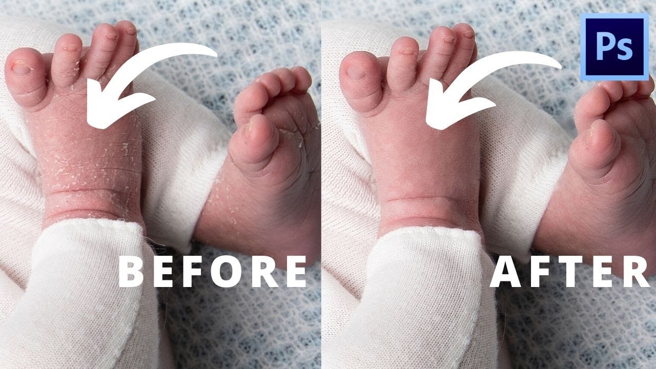 Save Time and Edit Dry/Peeling Skin Fast with This Photoshop Action ...