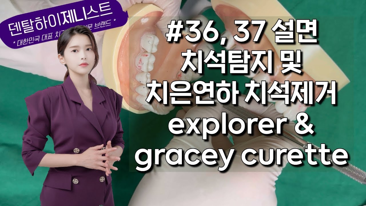 하악 좌측 대구치 설면 치석탐지 및 치은연하치석제거 | 치과위생사 국가고시 실기시험 explorer 탐침 gracey ...