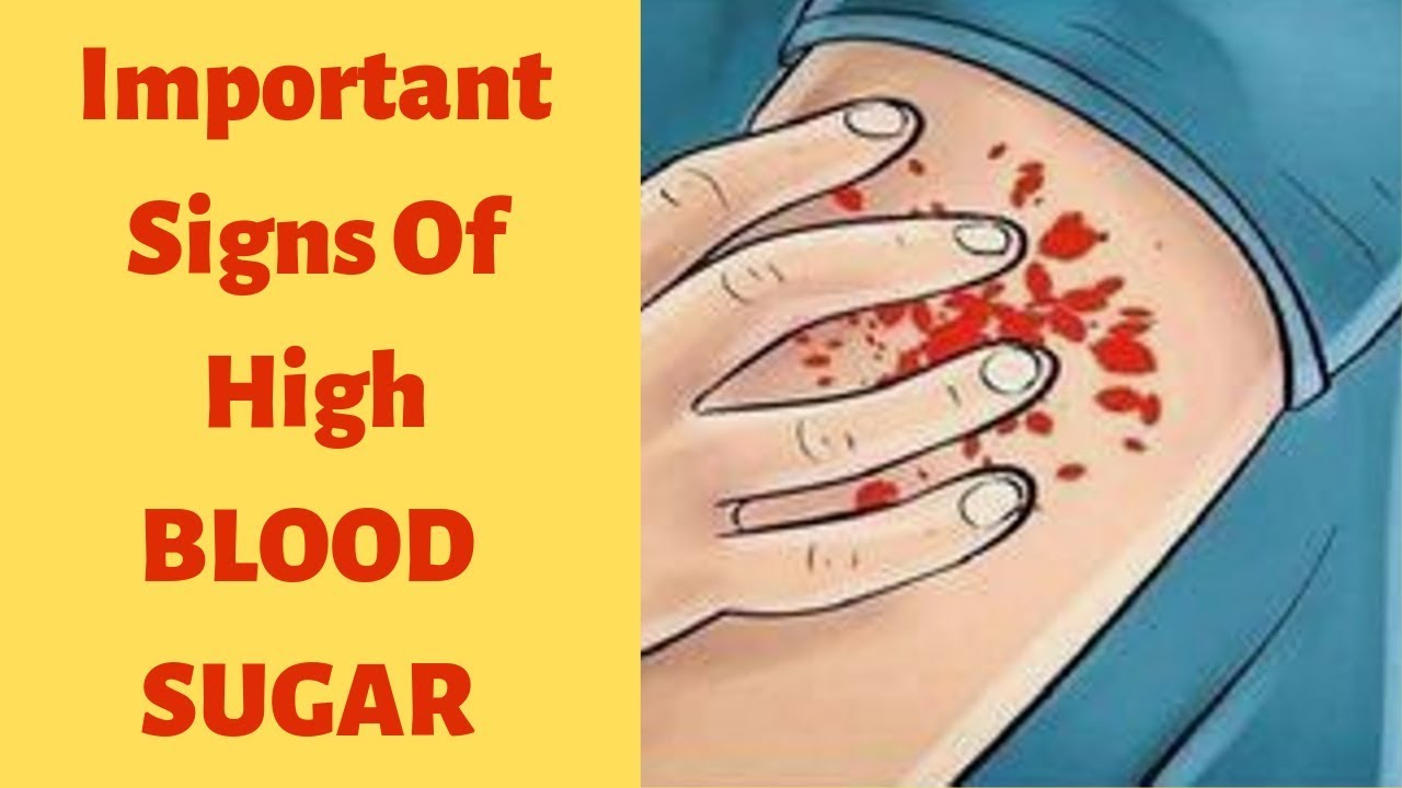 10 Early Warning Signs Your Blood Sugar Is Super High - YouTube