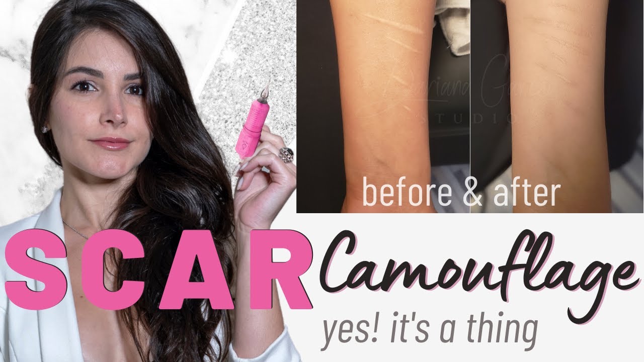 Scar Camouflage? BELIEVE IT! It's a thing and it provides WONDERFUL ...