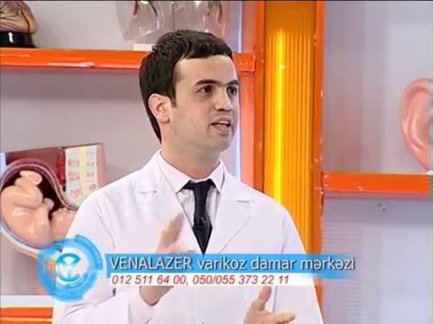 Varikoz Damar Müalicəsi. Dr. Samir Abdullayev Varikoz damar ...
