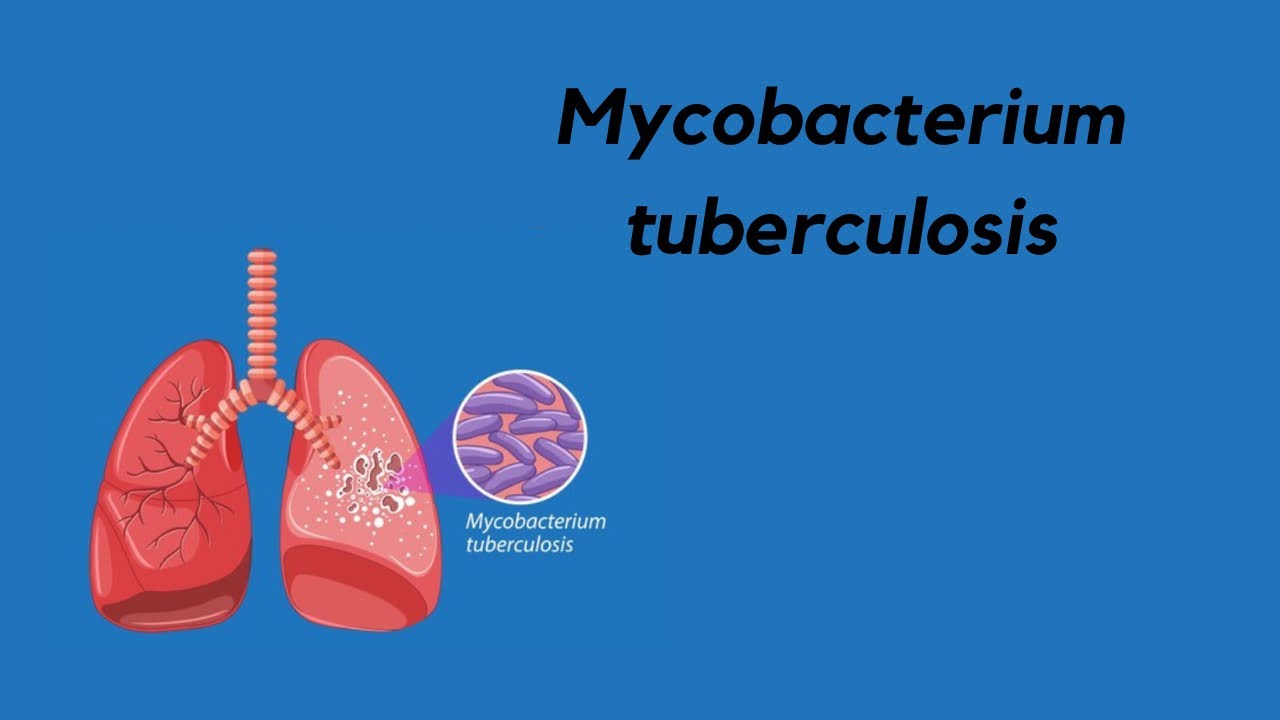Mycobacterium tuberculosis- Virulence factors | Pathogenesis - YouTube