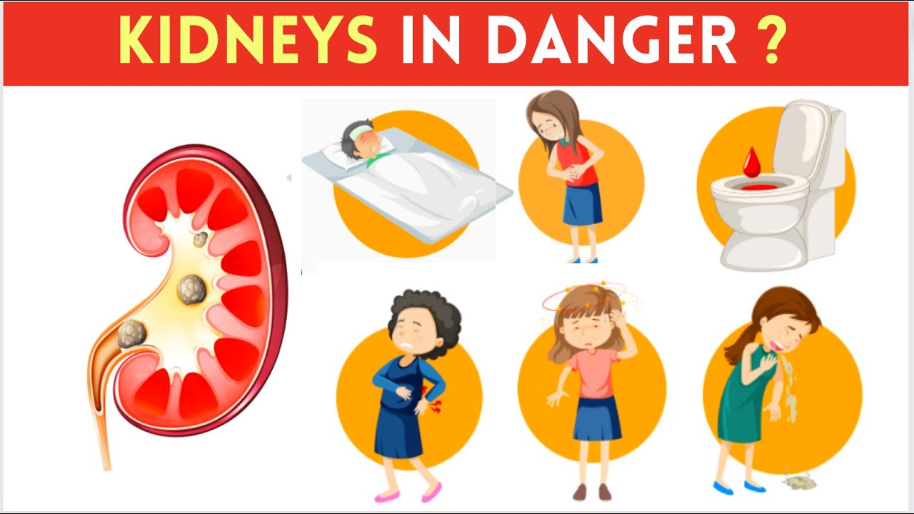 12 Signs That Your Kidneys Need Help! - YouTube