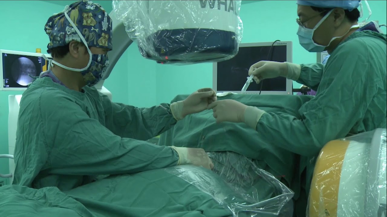 Spine surgery with RF Plasma Surgery System - YouTube