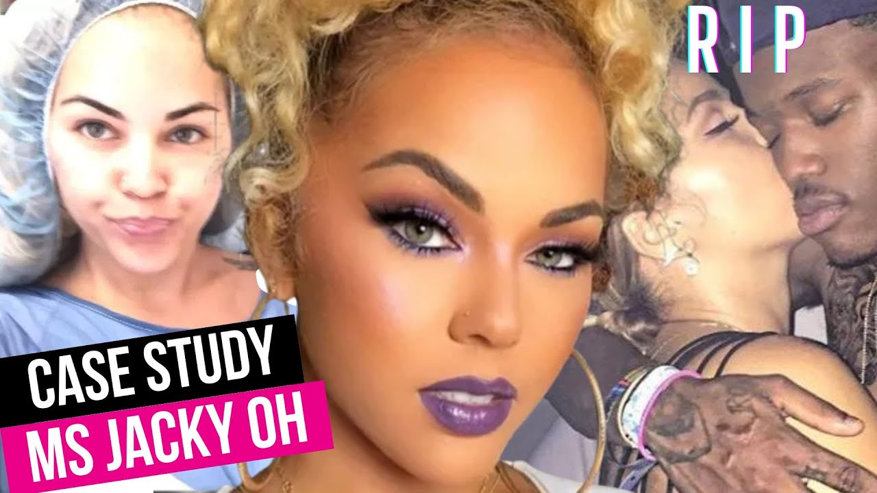 The TRUTH About Ms. Jacky Oh's Passing in Miami, Non-Board Certified Plastic Surgeon & DC Young ...