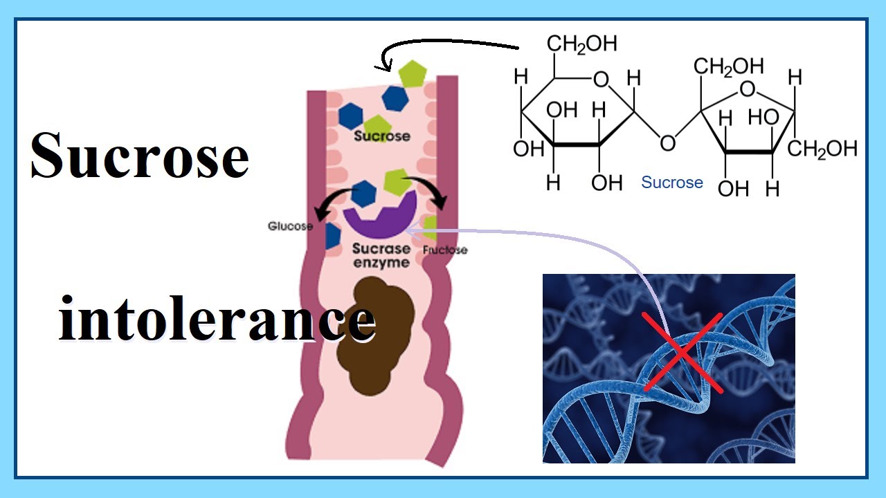 sucrose intolerance - YouTube