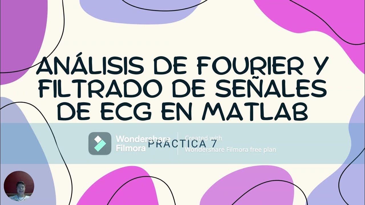 Práctica 7. Análisis de Fourier y Filtrado de señales ECG en MATLAB ...