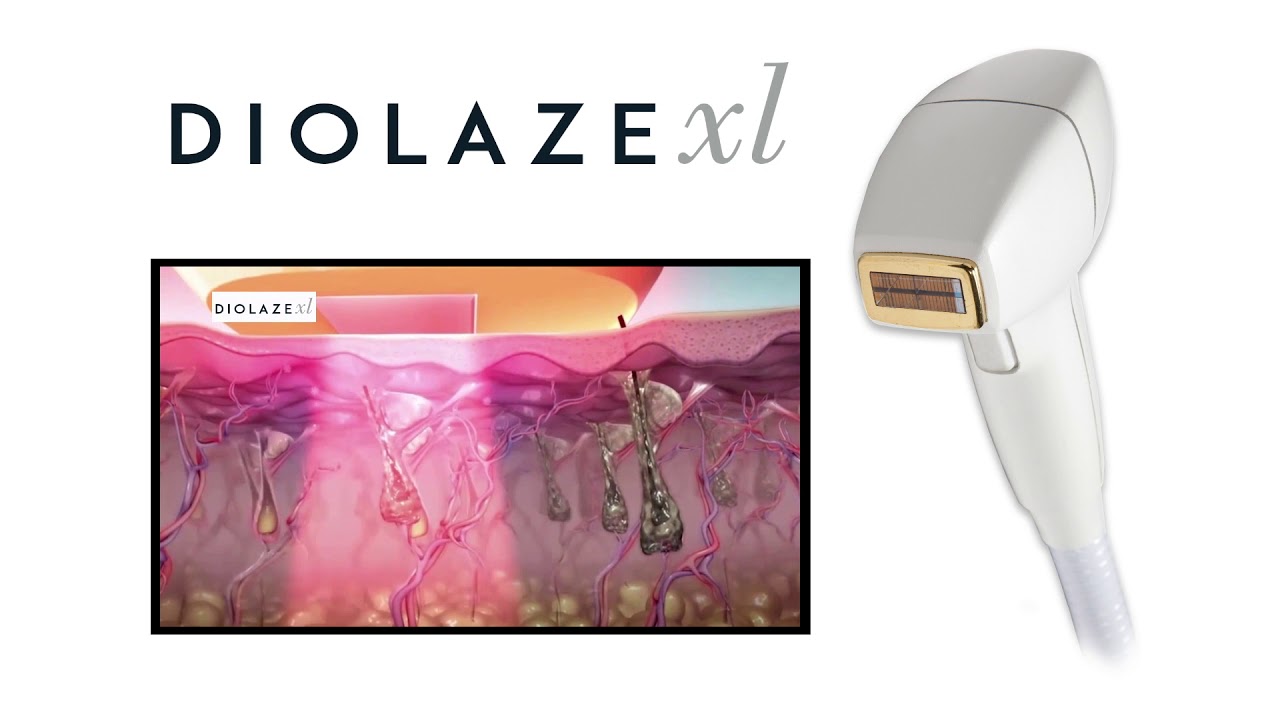 DiolazeXL at Perfect Skin Solutions - YouTube