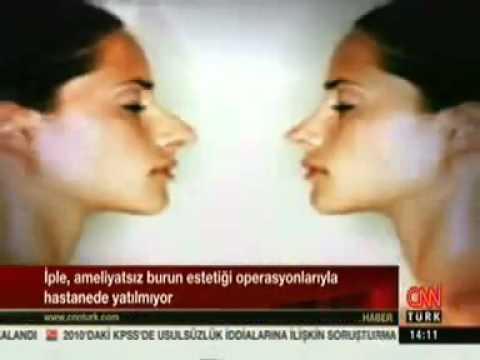 İple Ameliyatsız Burun Estetiği
