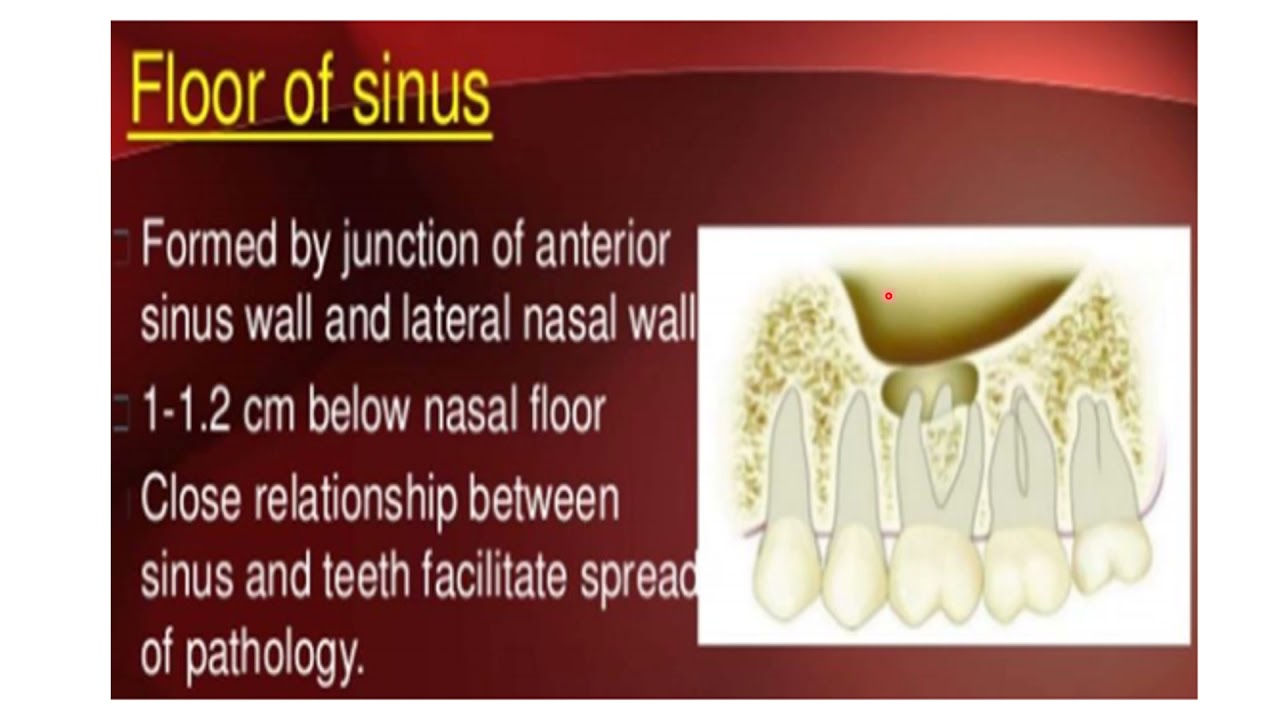 Oral Histology Lec.18(Maxillary Sinus) / Department of Dentistry/2nd ...