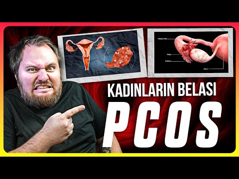 İnsanları Kısırlaştıran PCOS Neden Var?