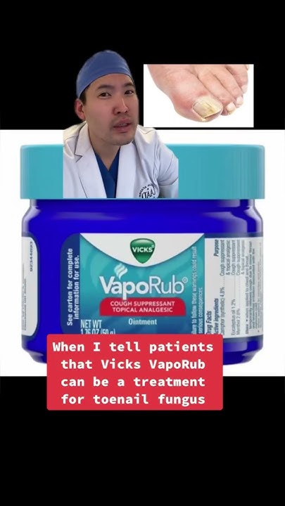 Vicks Vaporub For Toenail Fungus Youtube