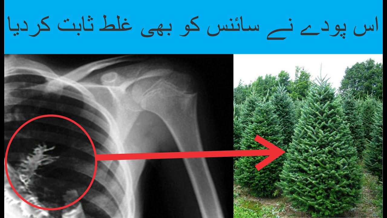 Plant Who Proved Science Wrong| Tree In Lungs| Strange Story - YouTube