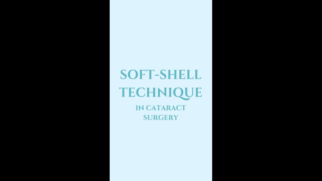 IN 60 SECONDS: Soft Shell technique in cataract surgery - YouTube
