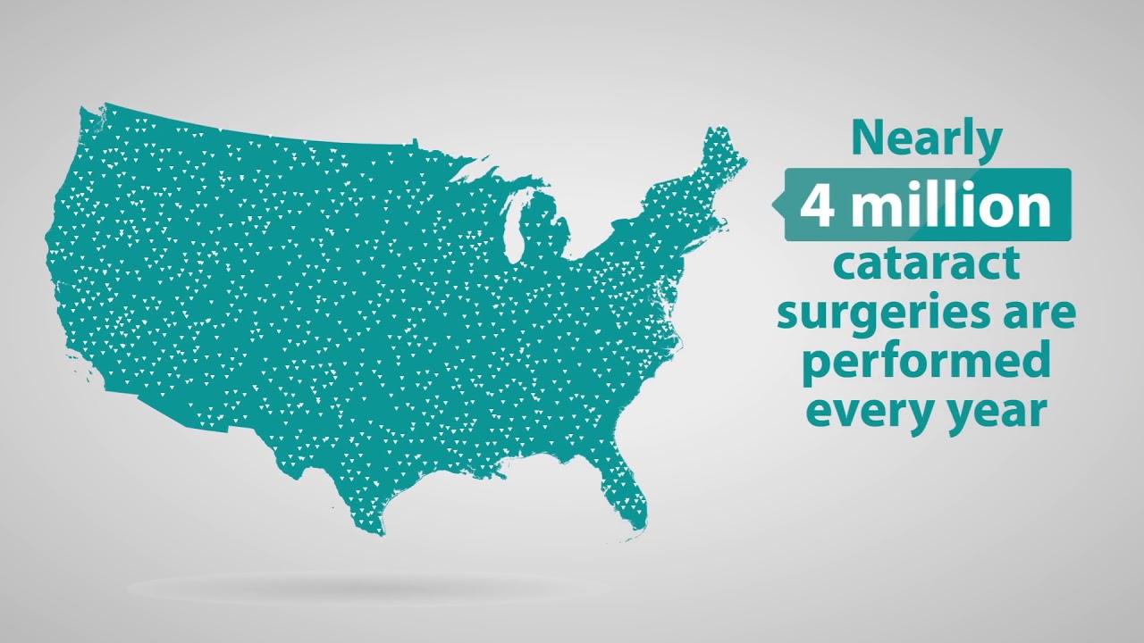 Cataracts Statistics - YouTube