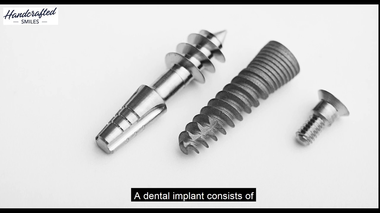 Teeth Implants | Handcrafted Smiles - YouTube