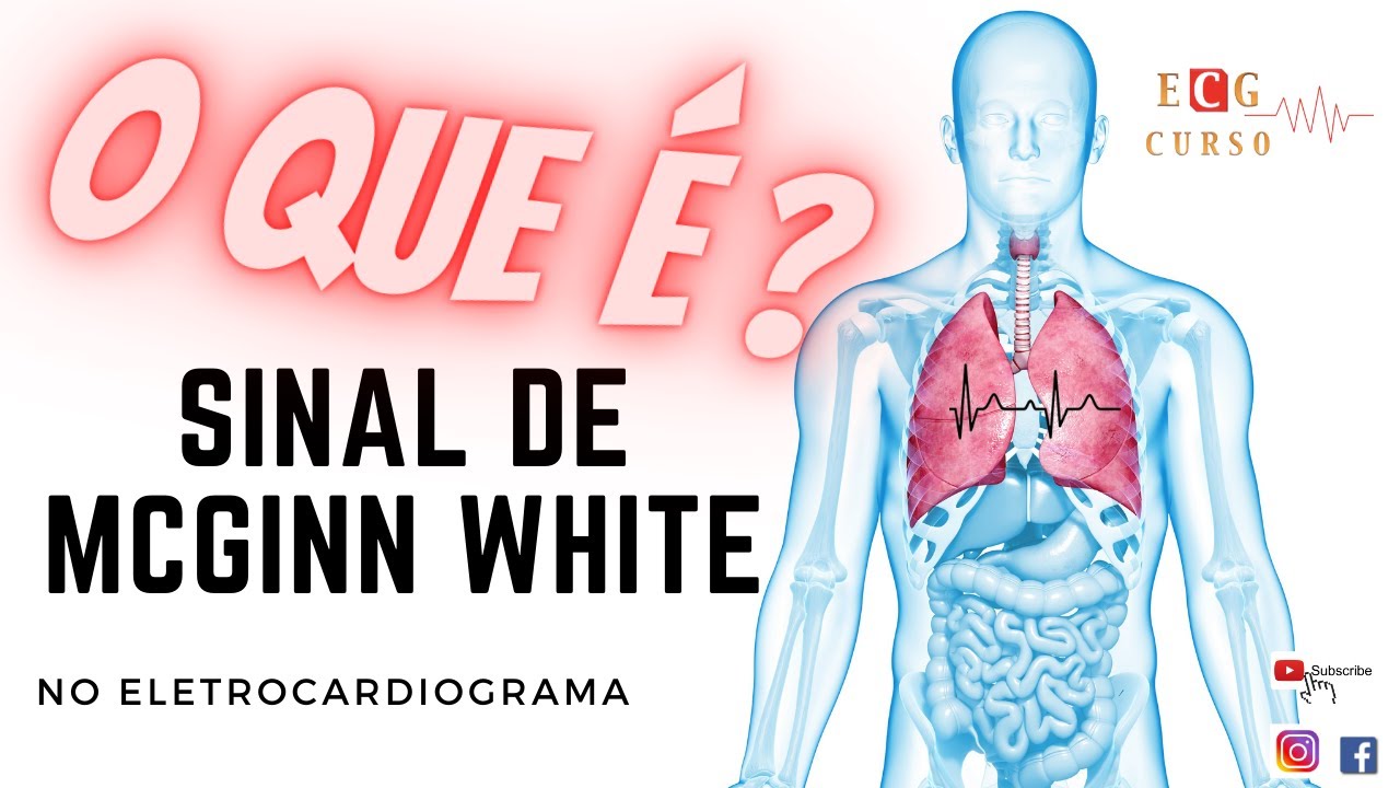 TRÍADE DE MCGINN WHITE: JÁ OUVIU FALAR DESSA ALTERAÇÃO NO ...