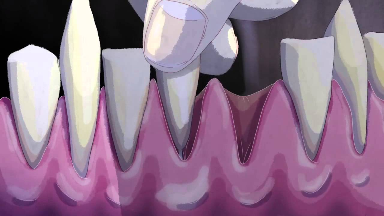 Teeth Trailer - YouTube