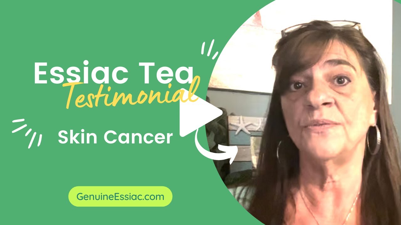 Skin Cancer Essiac Tea Testimonial - YouTube
