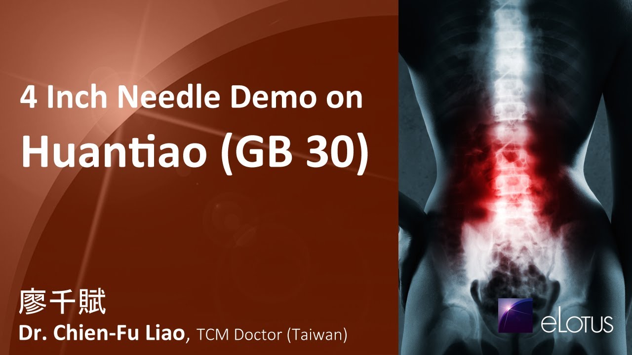 4 Inch Needle Demo on Huantiao (GB 30) with Dr. Chien-Fu Liao - YouTube