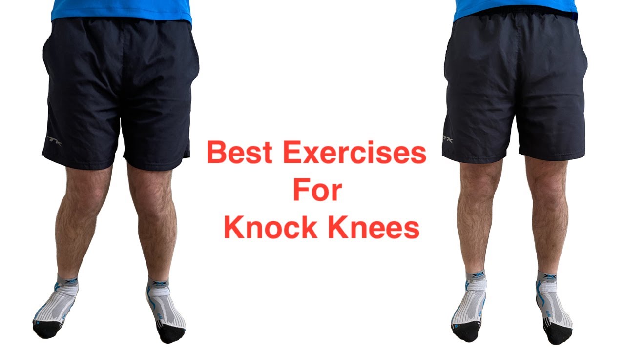Best Exercises For Knock Knees Youtube