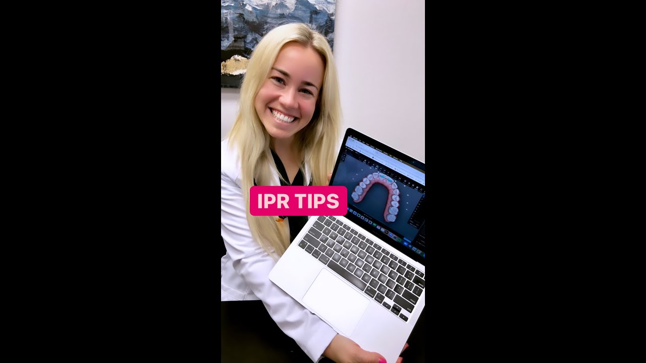 IPR Tips for Invisalign ClinChecks - YouTube