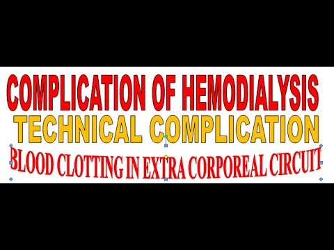 Complication of hemodialysis | BLOOD CLOTTING DURING DIALYSIS ...