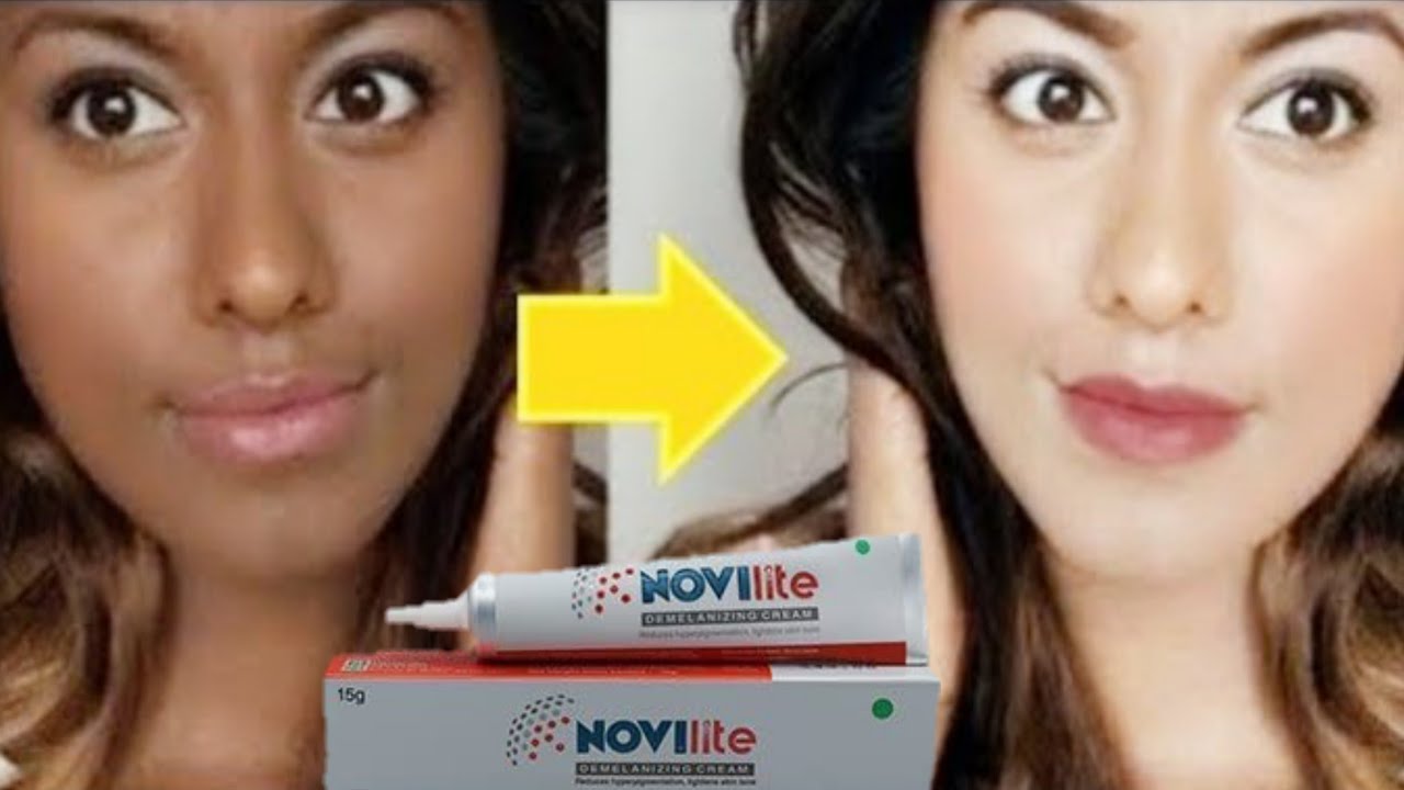 Novilite Cream | Remove pigmentation | Acne scar | pimples marks ...