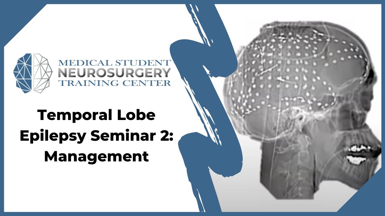 Temporal Lobe Epilepsy Seminar 2: Management - YouTube