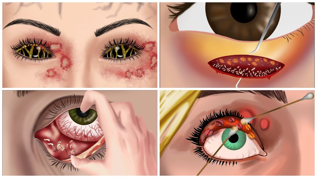 ASMR big animation collection of eye treatments and cleansing! You will ...