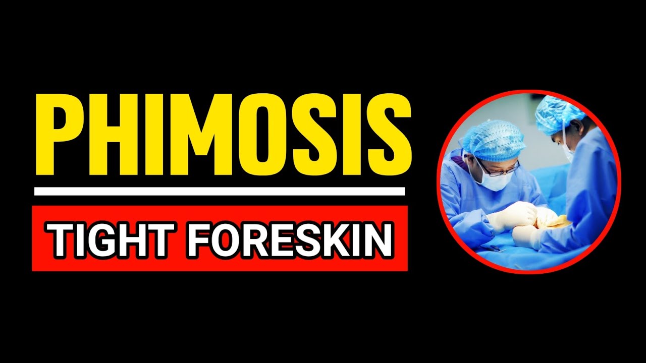 Phimosis : Causes, Symptoms, Diagnosis & Treatment | Viv Care - YouTube
