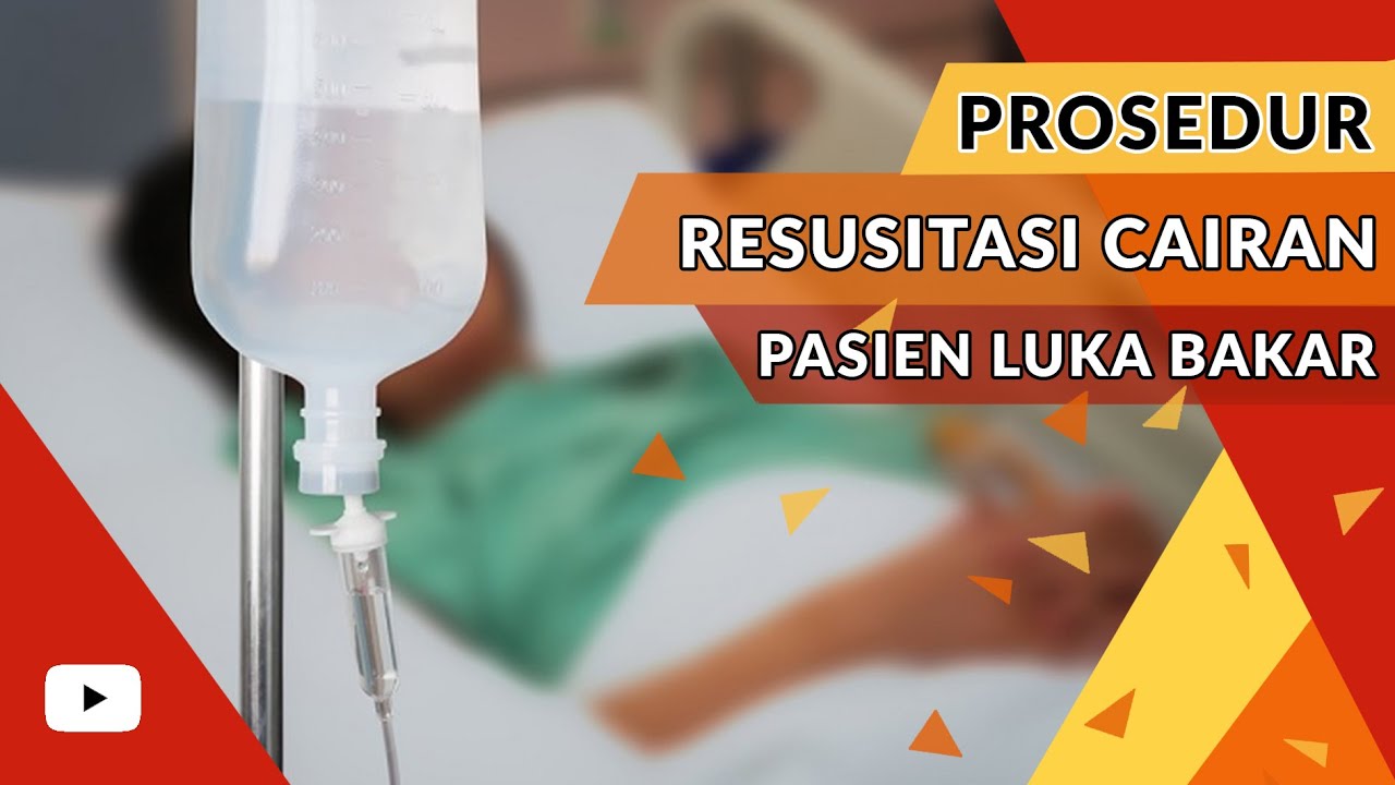 Prosedur Keperawatan - Resusitasi Cairan pada Pasien dengan Luka Bakar ...