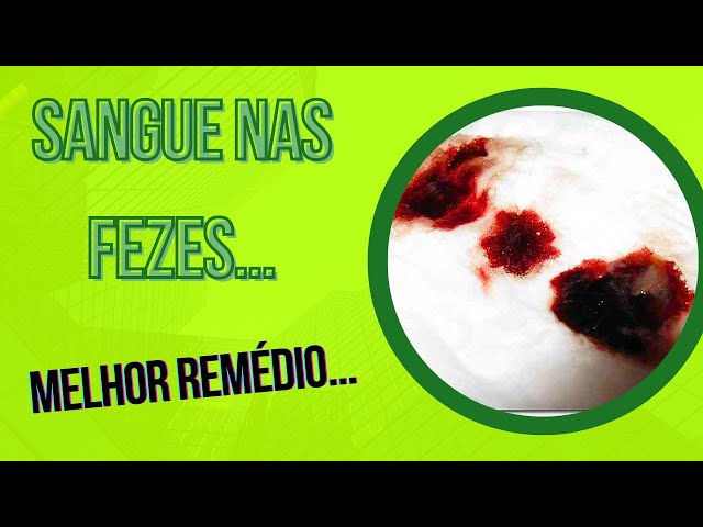 Coco De Cachorro Com Muco Seu Cachorro Está Apresentando Fezes Com