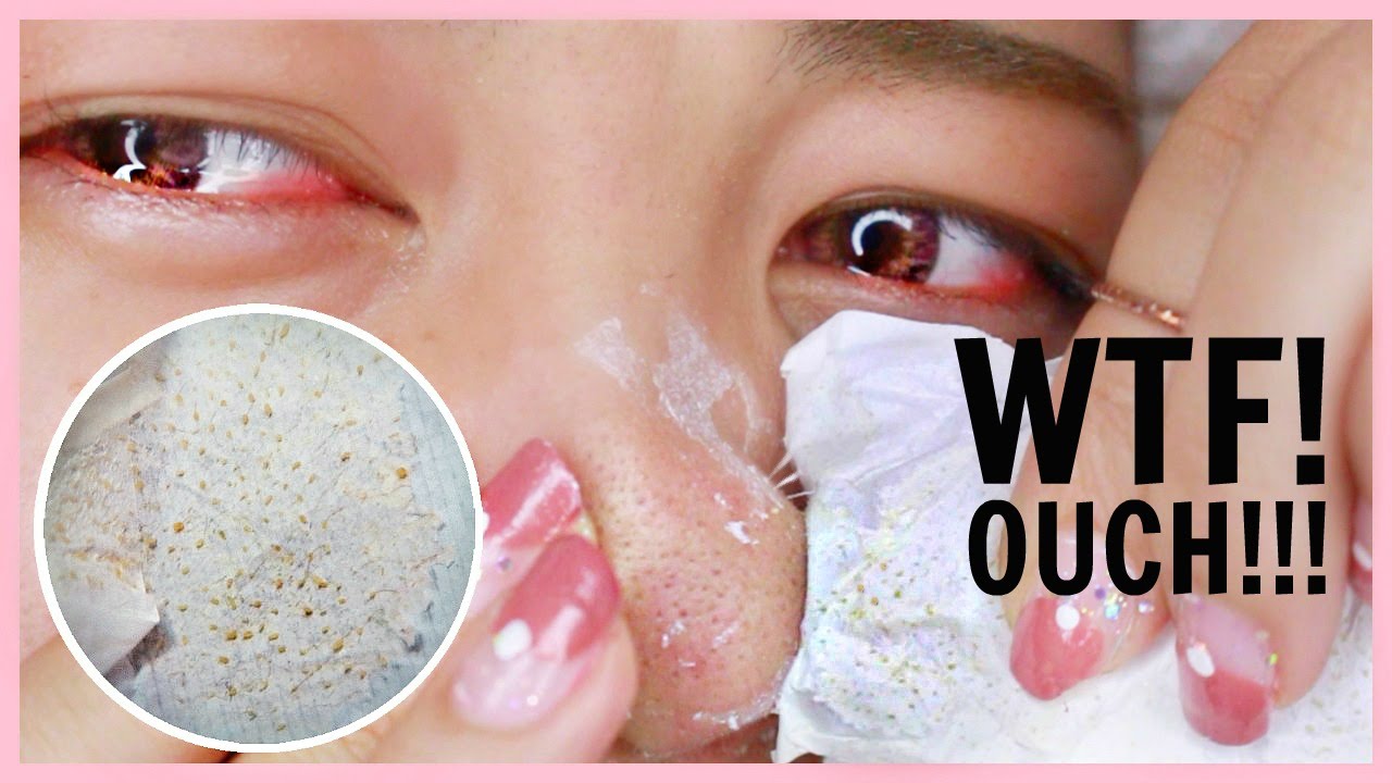MOST PAINFUL Blackhead Removal Product EVER YouTube most-painful-blackhead-removal-product-ever-youtube