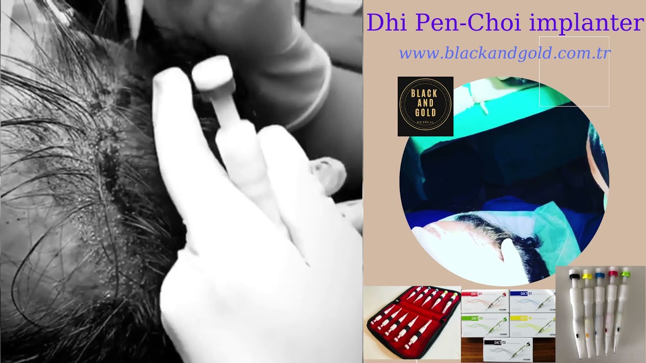 Dhi pen , Choi implanter pen, Saç ekim kalemi ( Saç - Sakal - Kaş ekimi ...