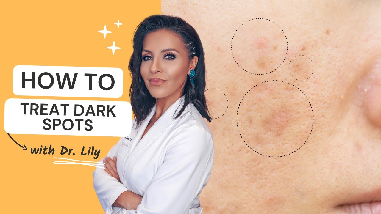 Dr. Lily Talakoub's Skin School: Products That Work To Treat Dark Spots ...