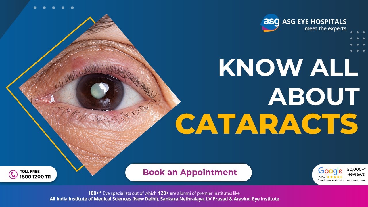 Know All About Cataracts | Treatments, Causes & Precations | ASG Eye ...