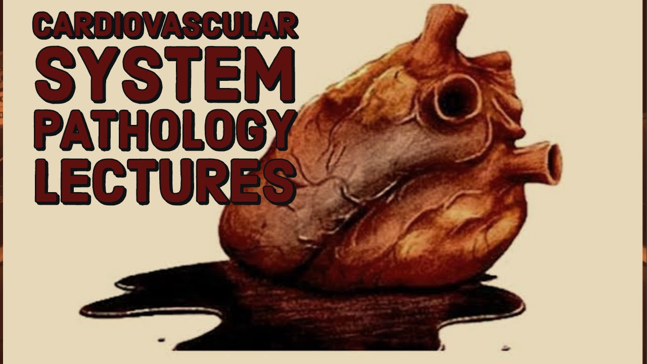 CARDIOVASCULAR SYSTEM Pathology lecture 1 Hypertensive Heart disease ...