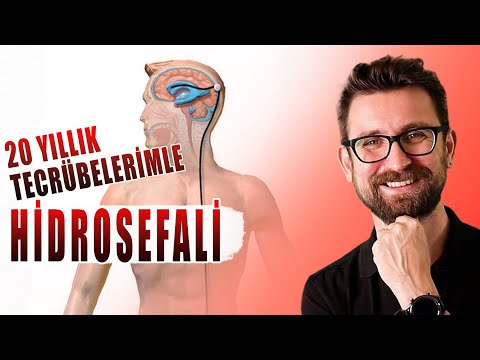 Hidrosefali ile 20 yılım nasıl geçti.
