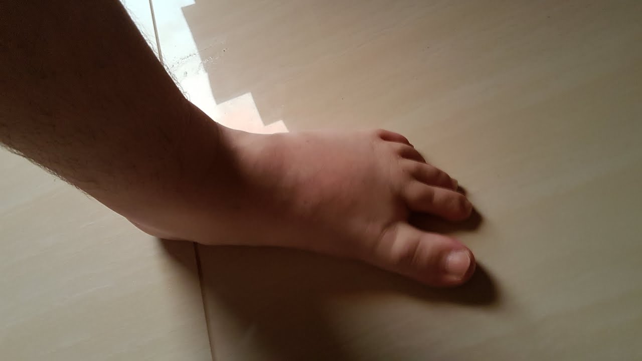 Squishing my toes! - YouTube