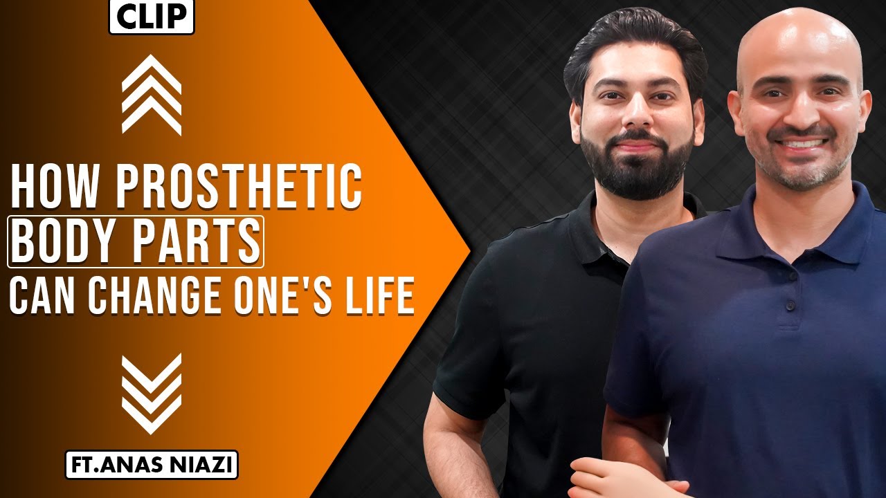 How Prosthetic Body Parts Can Change One's Life | Faizan Syed | Anas ...