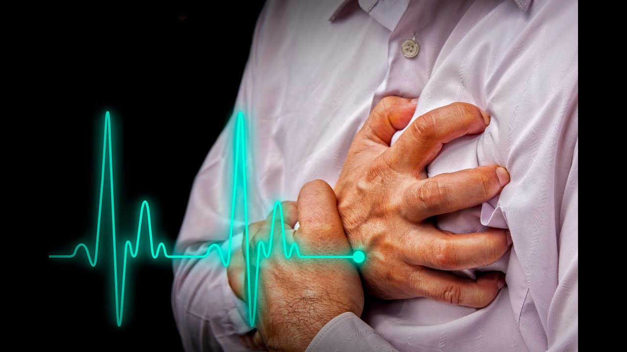 Surviving a heart attack with Dr Finlay - YouTube