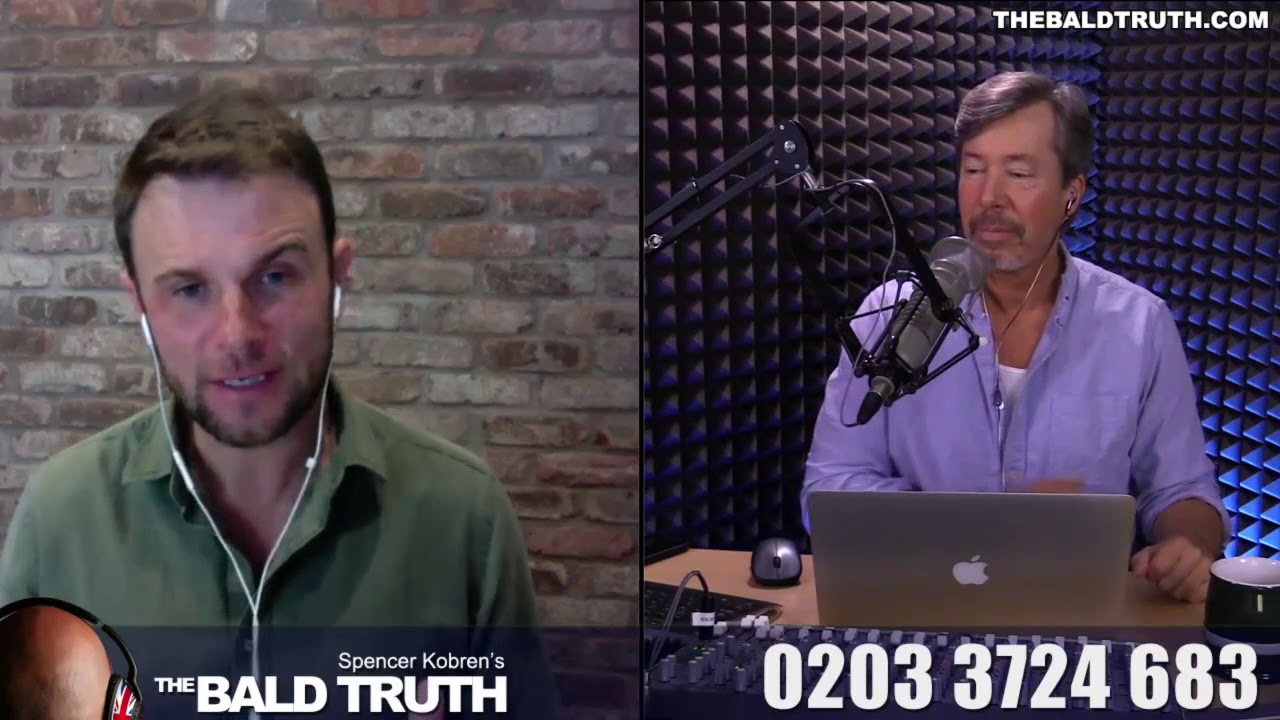 The Bald Truth UK Episode 1 | Hair Loss Industry is NOT to be trusted ...
