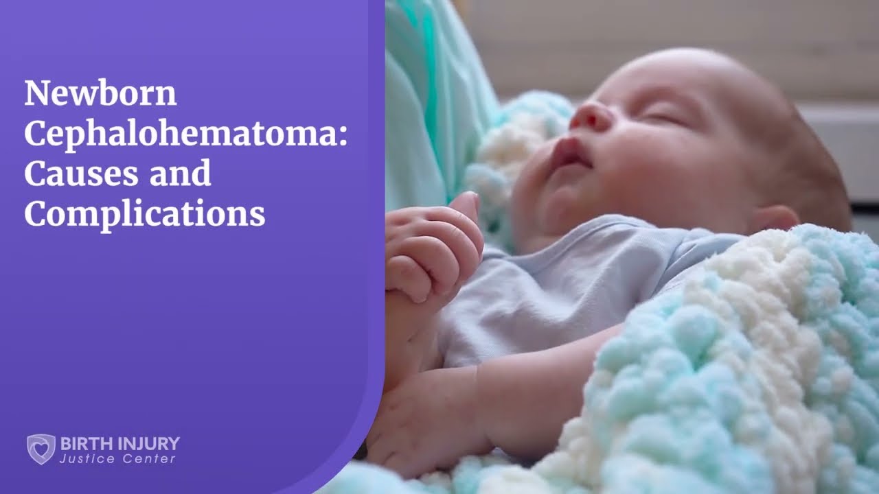 Cephalohematoma Vs Caput Succedaneum